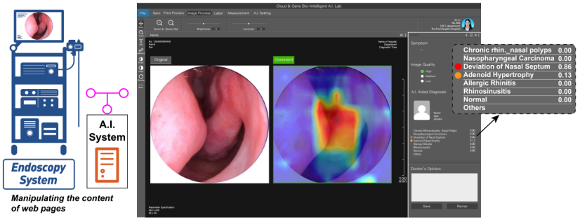 GitHub - zhenzhang-li/Nose-AI-system
