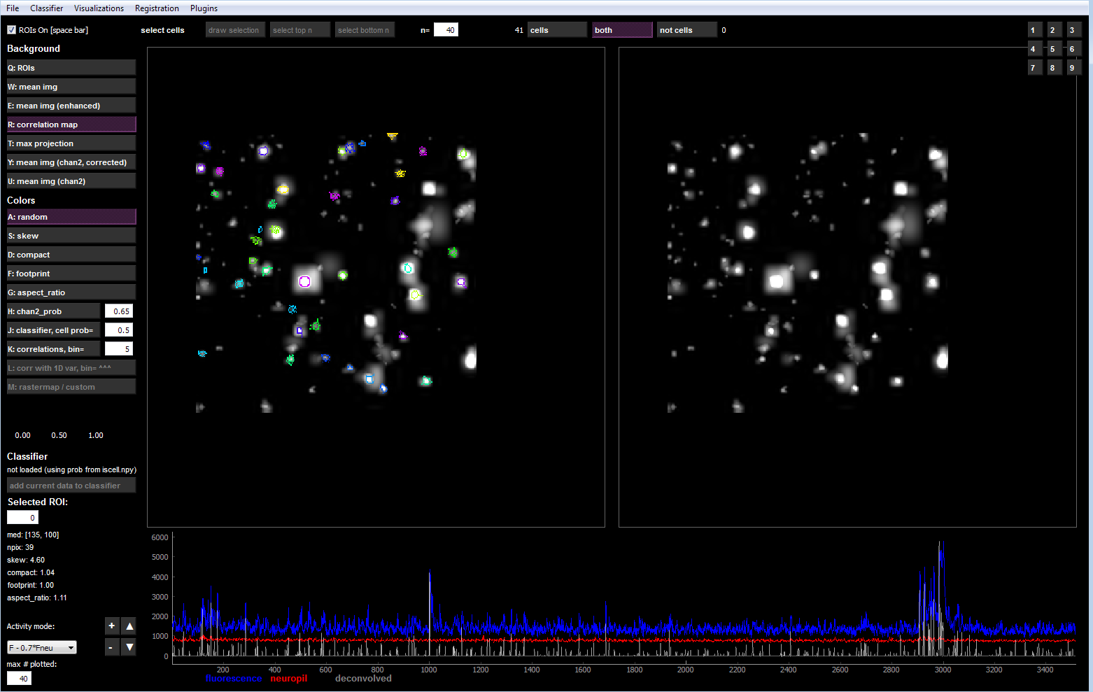 ROI detection issues in v0.6.3 · Issue #193 · MouseLand/suite2p · GitHub