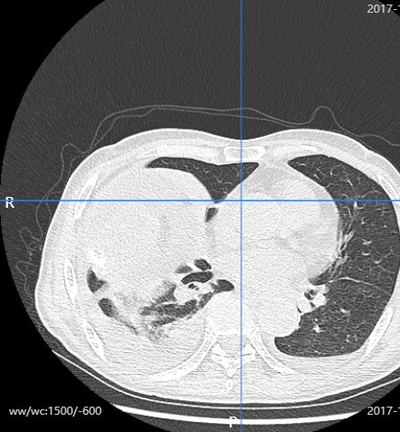 how to translate from brightness/contrast to dicom windowWidth/windowCenter · Issue #126 · rii ...