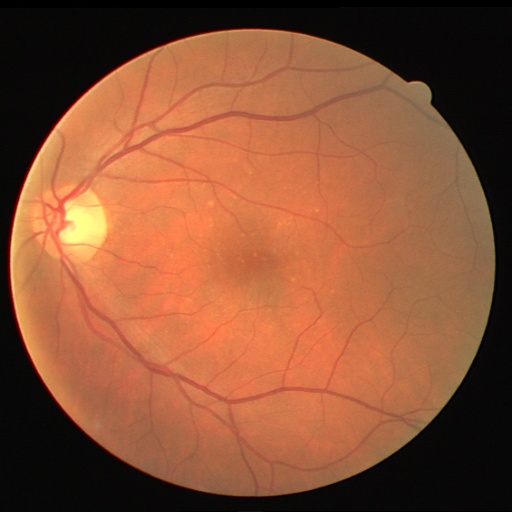 GitHub - Vishvesh-Kodihal/Retinal_Blood_Vessel_Segmentation_Using_Unet ...