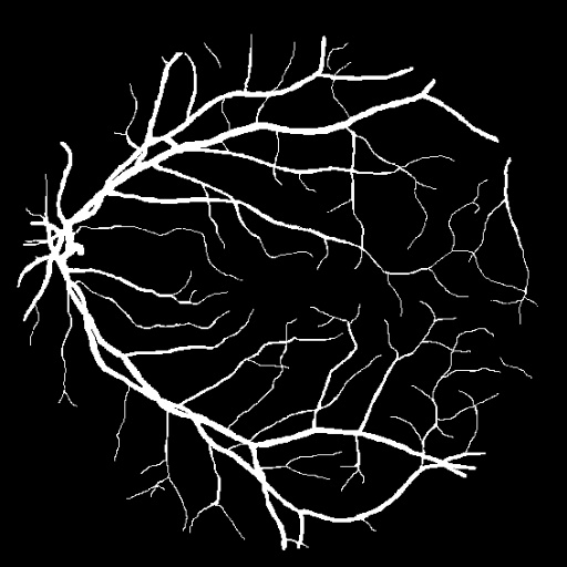 GitHub - Vishvesh-Kodihal/Retinal_Blood_Vessel_Segmentation_Using_Unet ...