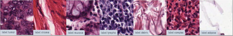 GitHub - StasVino/Histopathology-Classification