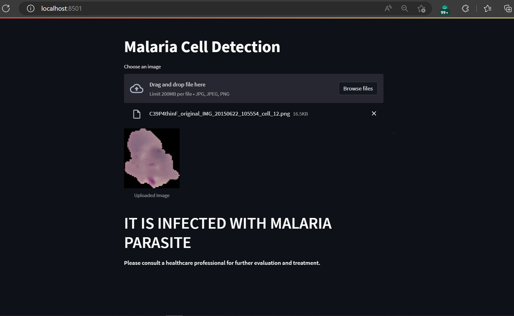 GitHub - RaySourish/Malaria-Cell-Detection: This GitHub project focuses ...