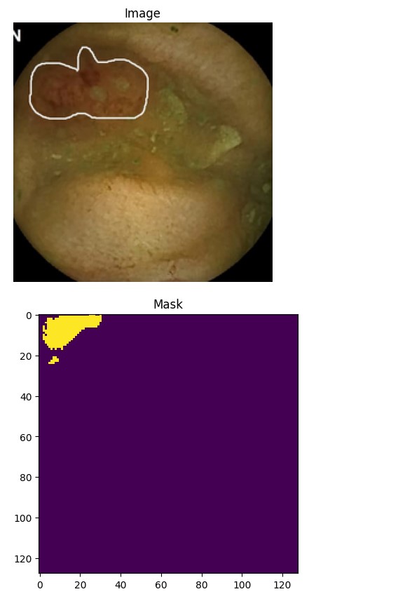 GitHub - kanchi12P/Med-AI_Auto-WCEBleedGen