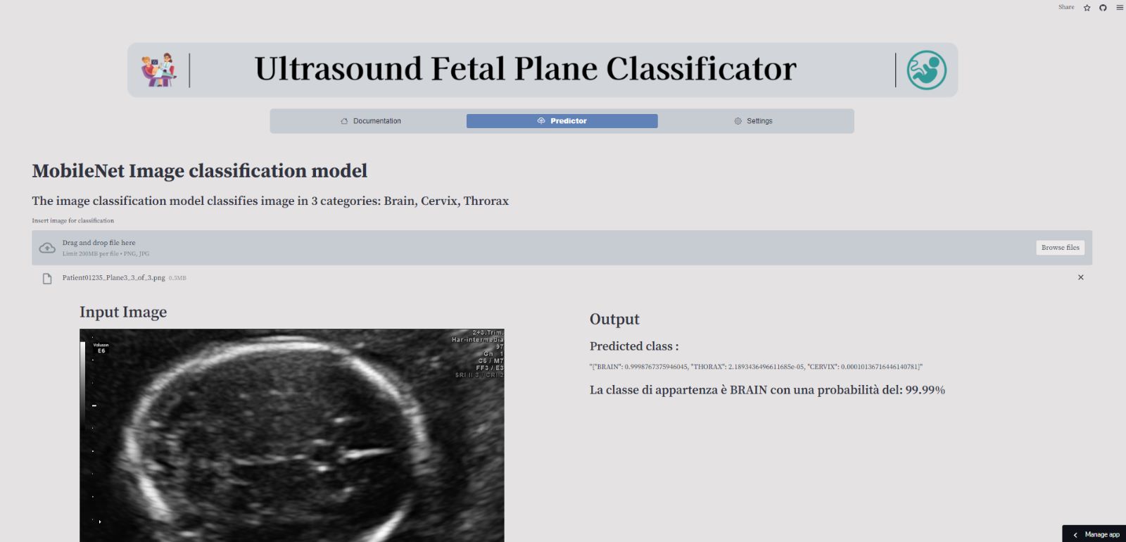 GitHub - M-ballabio1/API-Ultrasound-Classificator: API for multi-class classification of ...