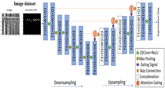 GitHub - Mousamoradi/Kidney_segmentation_Residual_Attention_UNET