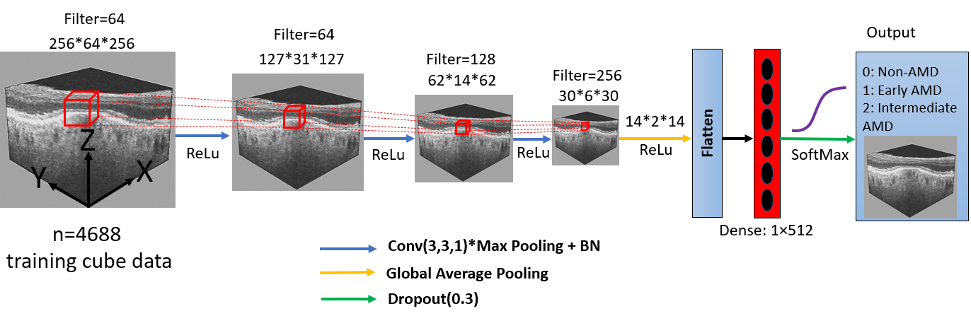 GitHub - Mousamoradi/AMD-Diagnosis: Non-advanced AMD grades [G1,2,3 ...