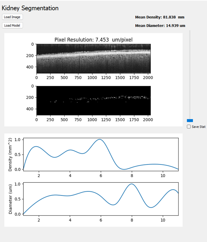 GitHub - Mousamoradi/GUI-for-kidney-predictions