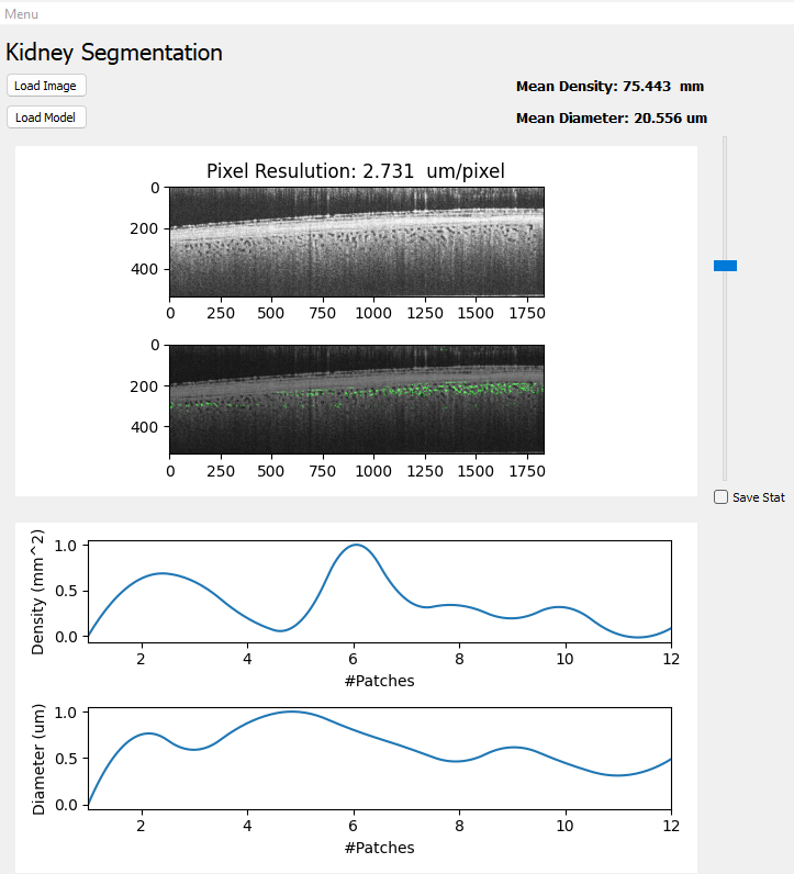 GitHub - Mousamoradi/GUI-for-kidney-predictions
