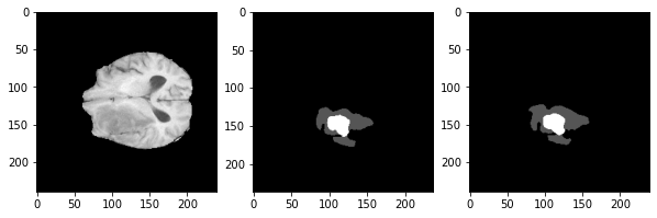 Github Alishermyrgyyassov Mednext On Brats2021