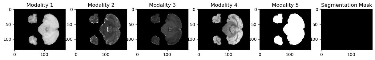 GitHub - AlisherMyrgyyassov/BRATS-DeepLearning-Utility-Toolkit: The BRATS Toolkit is a suite of ...