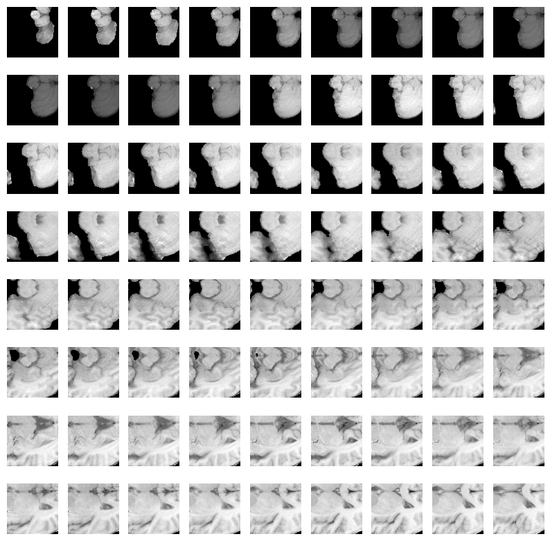 GitHub - AlisherMyrgyyassov/BRATS-DeepLearning-Utility-Toolkit: The BRATS Toolkit is a suite of ...