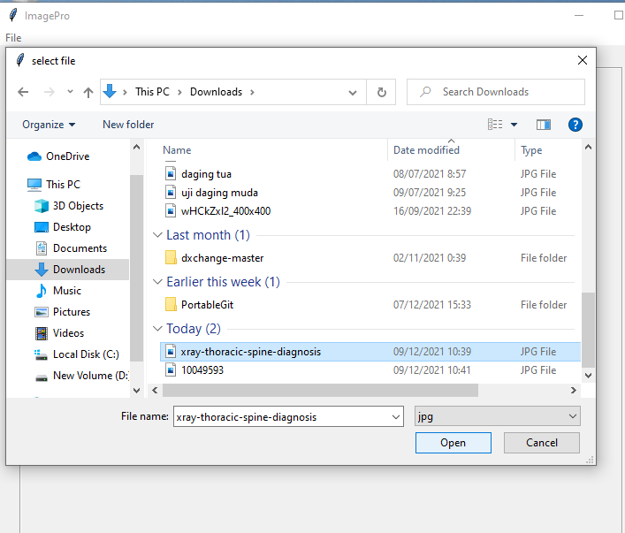 GitHub - widhi-mahardi-darma/CLAHE_GUI: Image Processing medical image ...