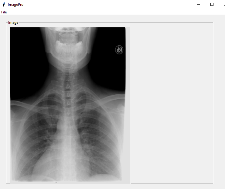 GitHub - widhi-mahardi-darma/CLAHE_GUI: Image Processing medical image ...