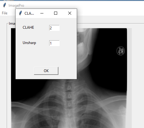 GitHub - widhi-mahardi-darma/CLAHE_GUI: Image Processing medical image ...