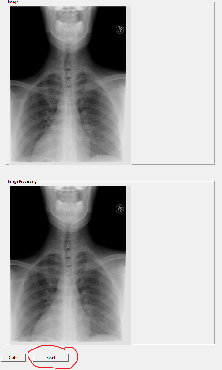 GitHub - widhi-mahardi-darma/CLAHE_GUI: Image Processing medical image ...