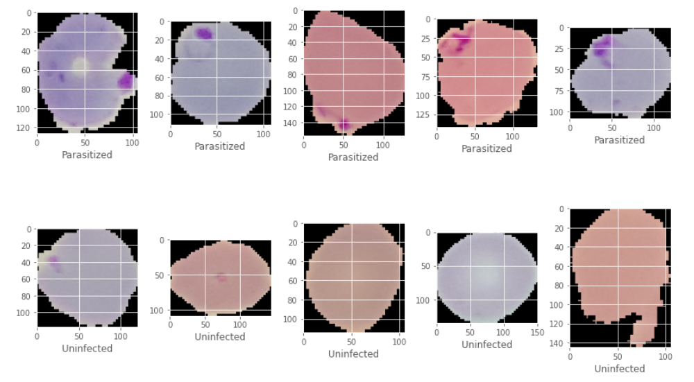 GitHub - k-aniket47/Malaria-blood-cell-Detection