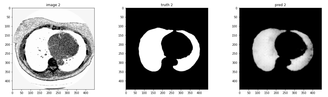GitHub - k-aniket47/Medical-Images-Segmentation