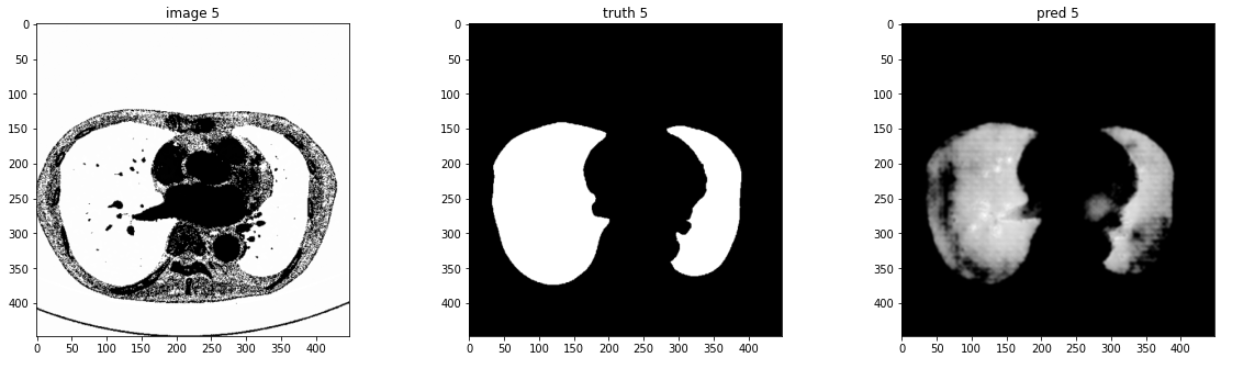 Github K Aniket47 Medical Images Segmentation