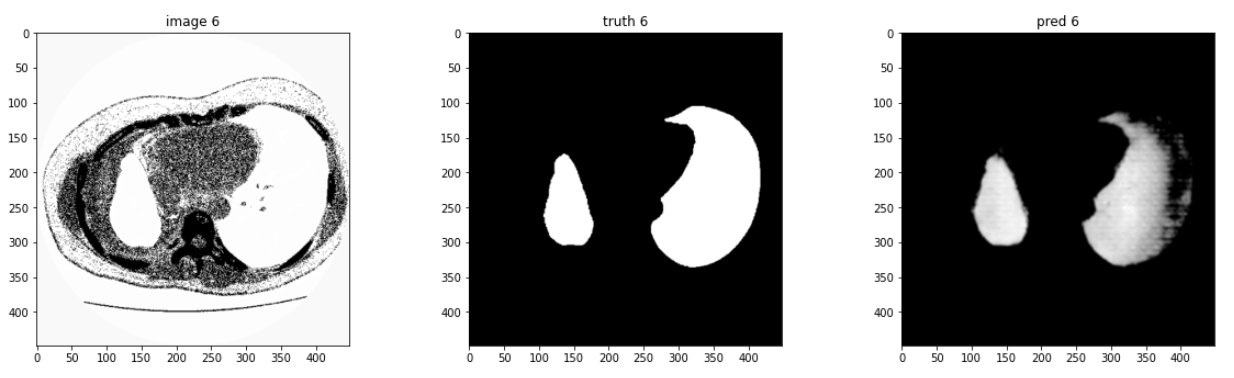 GitHub - k-aniket47/Medical-Images-Segmentation