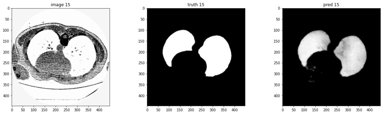 GitHub - k-aniket47/Medical-Images-Segmentation