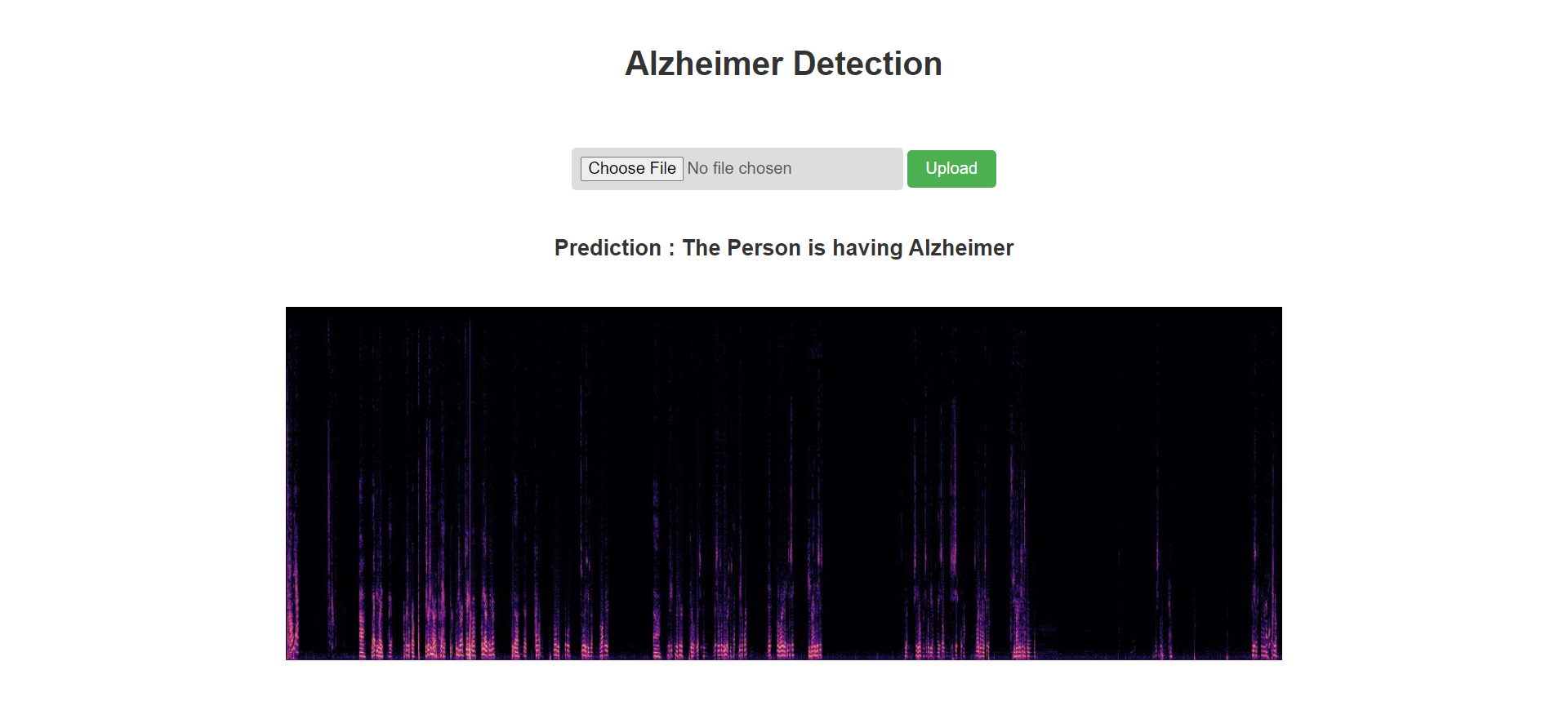 Github K Aniket47 Alzheimers Disease Detection Using Speech