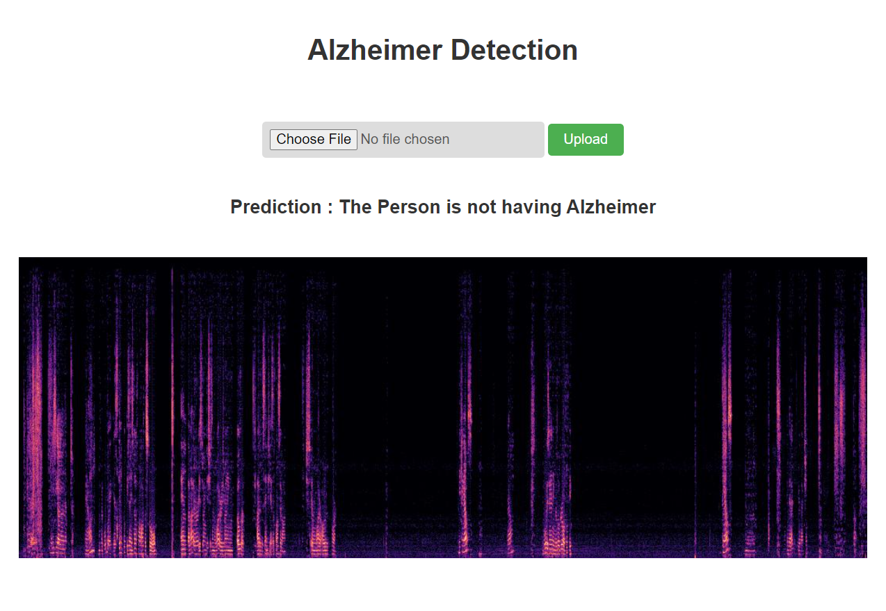 Github K Aniket47 Alzheimers Disease Detection Using Speech
