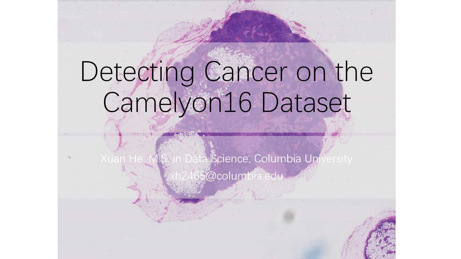 GitHub - Xuan-He-97/Detecting-Cancer-in-the-CAMELYON16-dataset