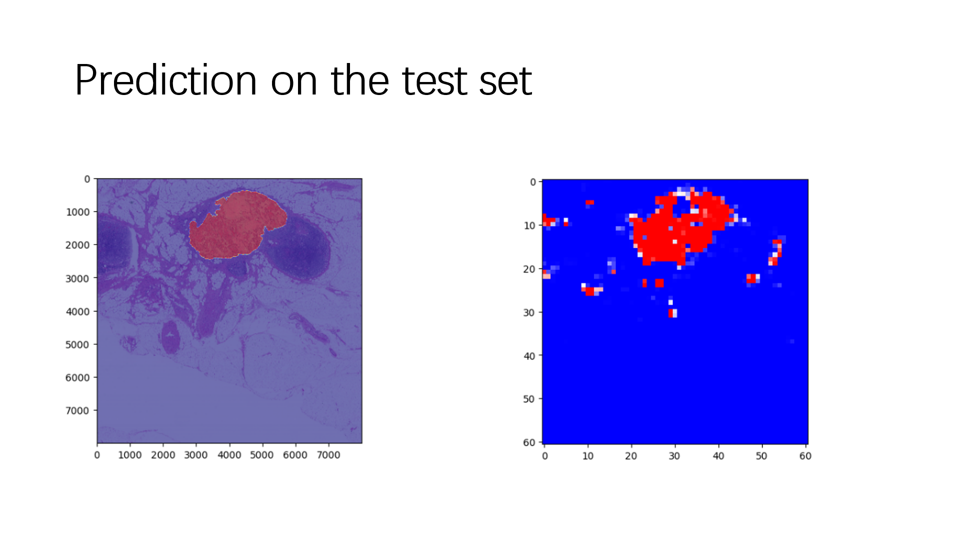 GitHub - Xuan-He-97/Detecting-Cancer-in-the-CAMELYON16-dataset