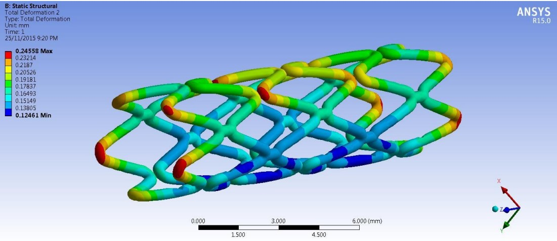 GitHub - claraaibar/Analisis-de-MEFS-aneurismas-y-stents