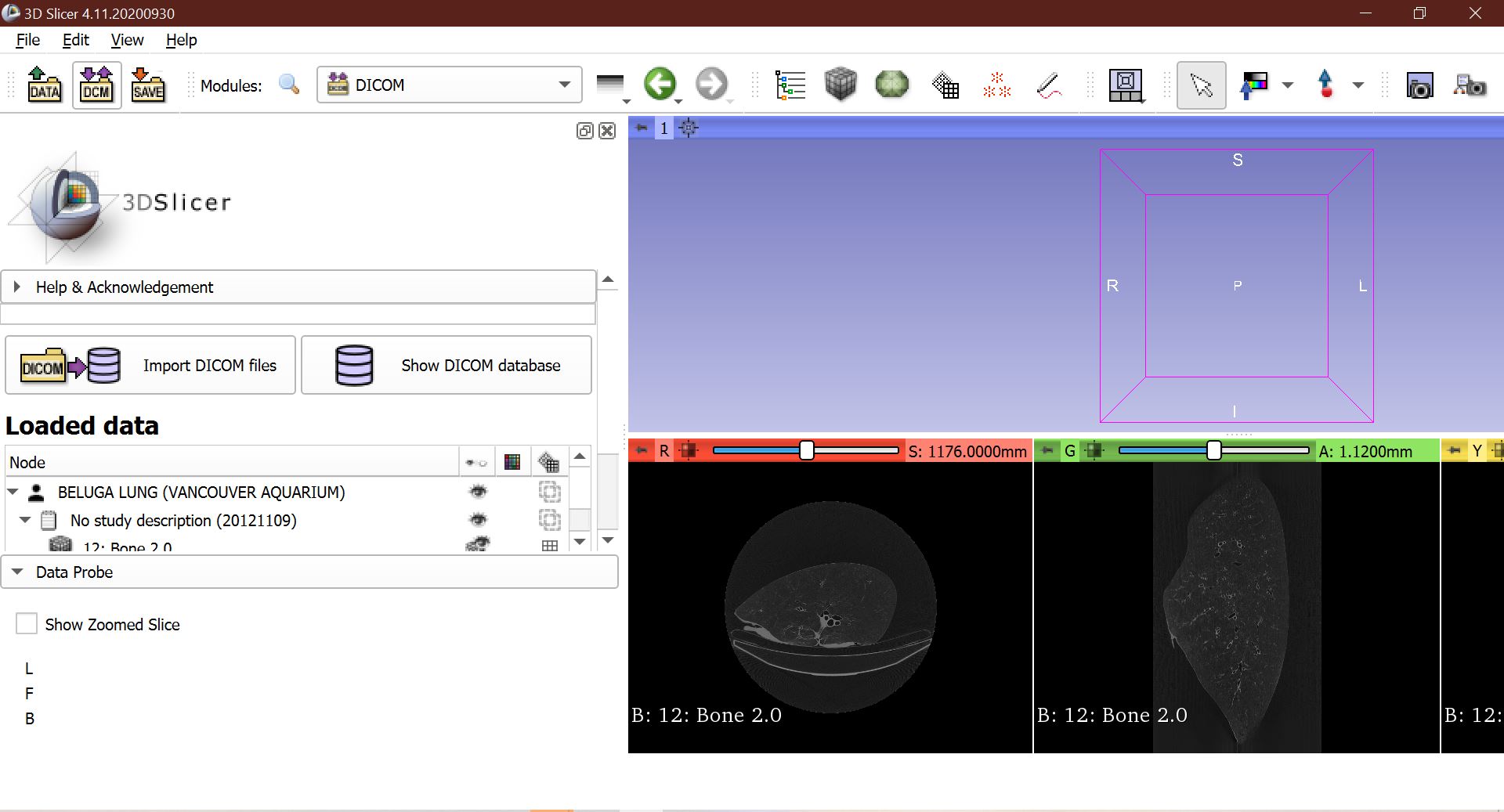 Slicer 4.6.2 vs Slicer 4.11.2020090 · Issue #5476 · Slicer/Slicer · GitHub