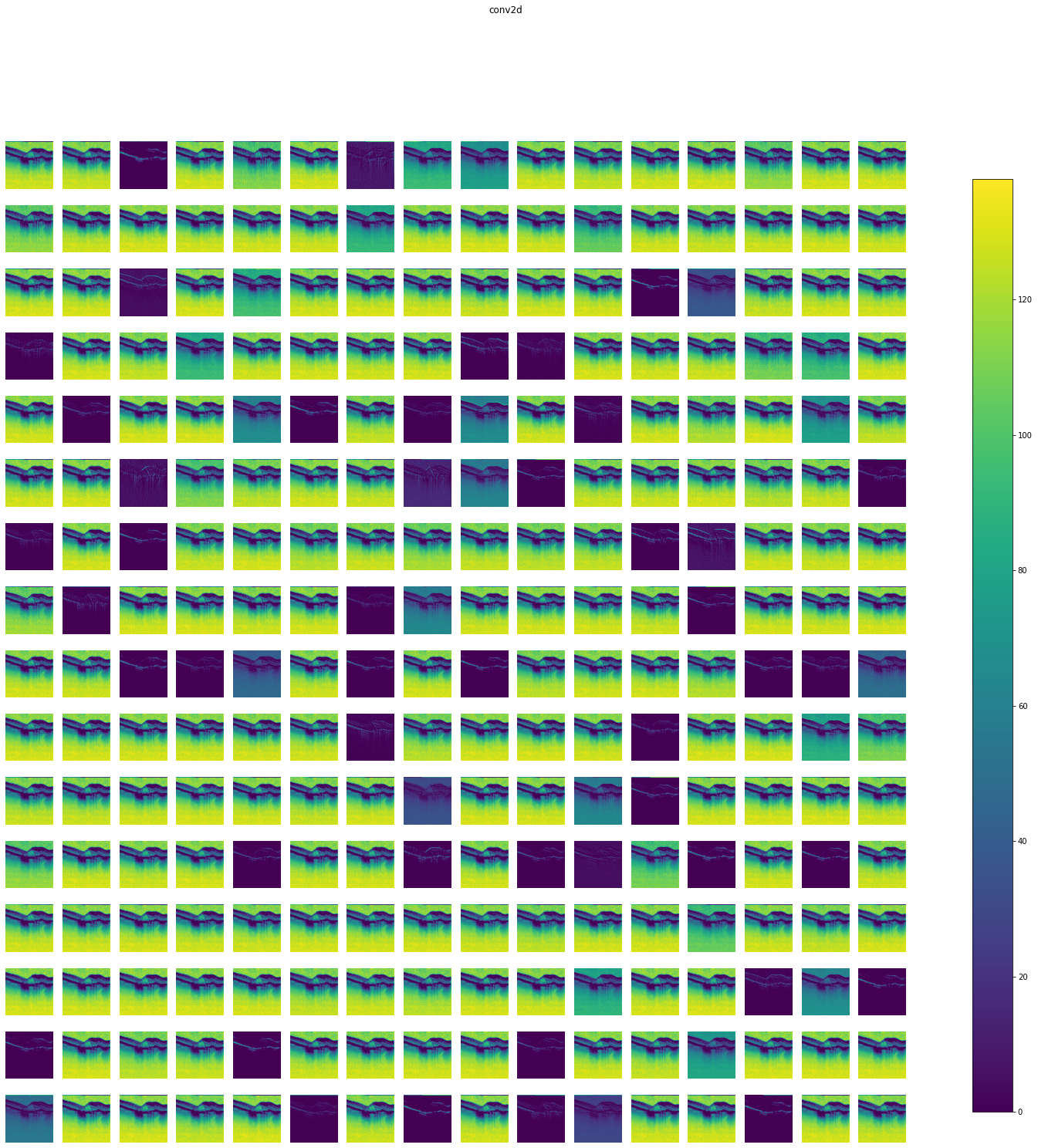 GitHub - haozujz/oct-classification: Multi-class image classification of retinal Ocular ...