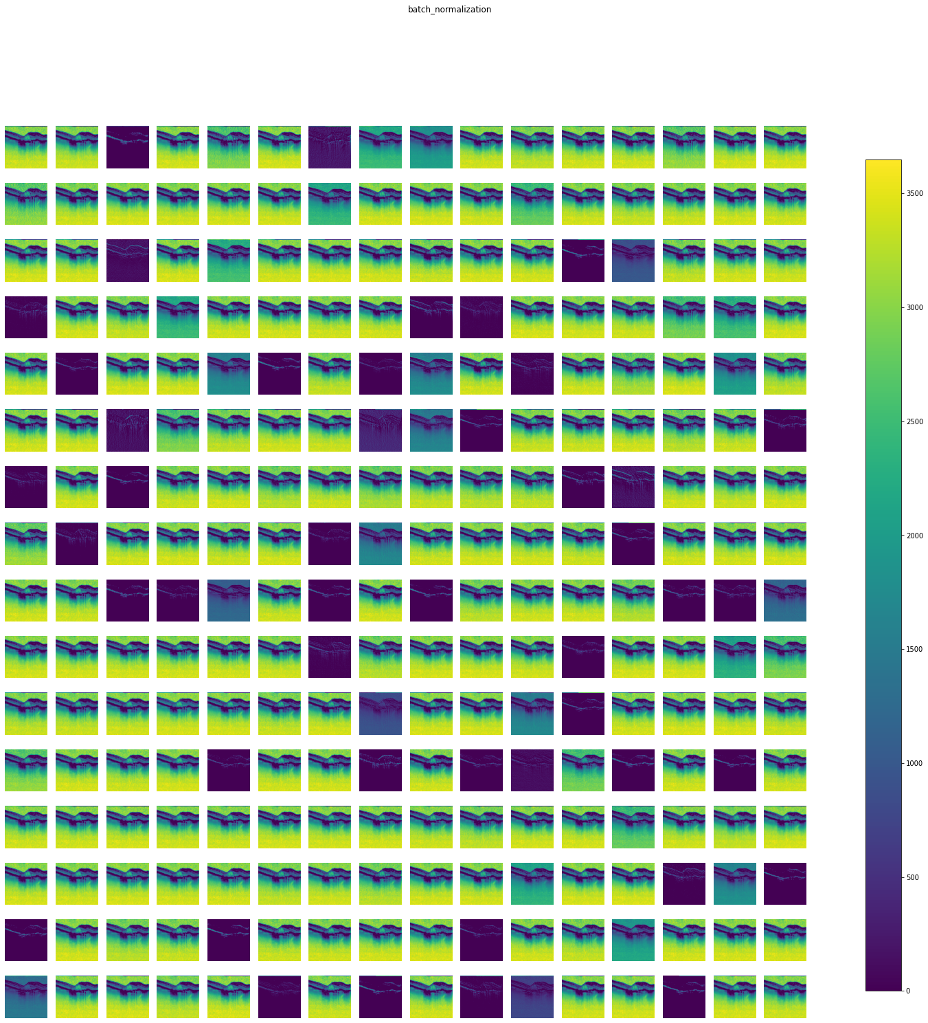 GitHub - haozujz/oct-classification: Multi-class image classification of retinal Ocular ...