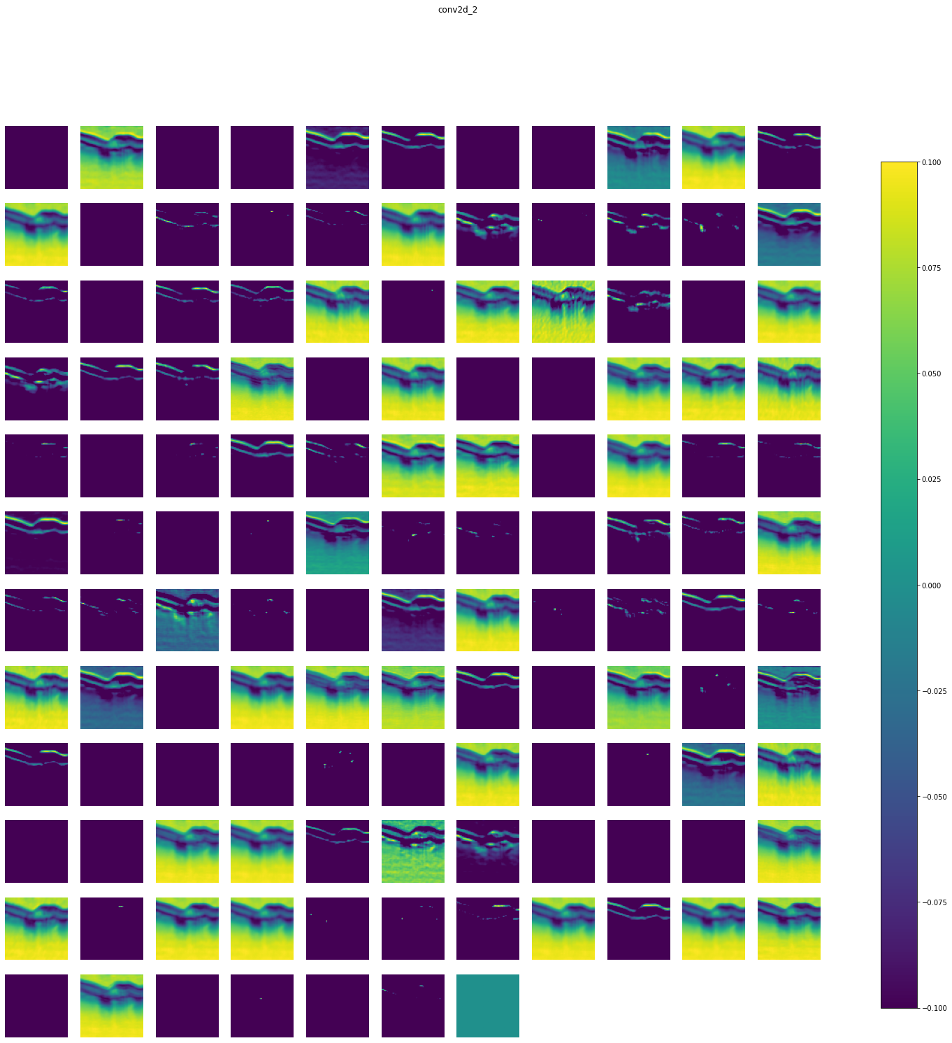 GitHub - haozujz/oct-classification: Multi-class image classification of retinal Ocular ...