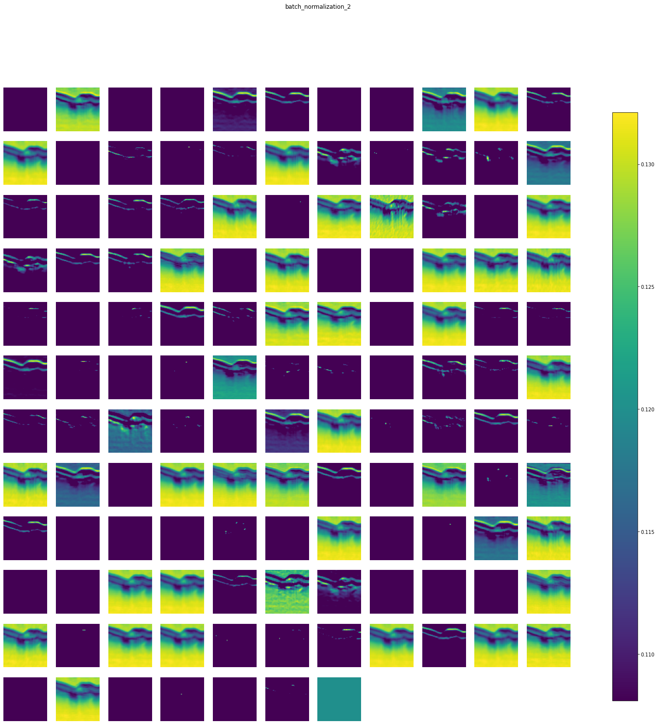 GitHub - haozujz/oct-classification: Multi-class image classification of retinal Ocular ...