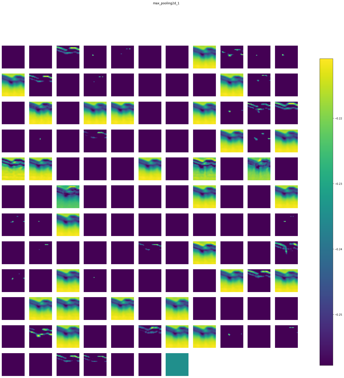 GitHub - haozujz/oct-classification: Multi-class image classification of retinal Ocular ...