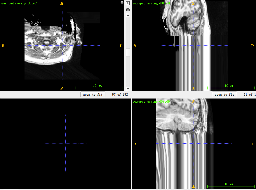 boolear index error · Issue #14 · cwmok/LapIRN · GitHub