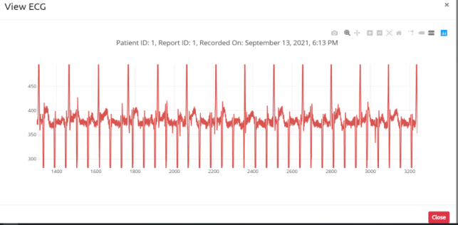 GitHub - Ibrahim-995/RemECG: An IoT Based Remote Electrocardiography System.