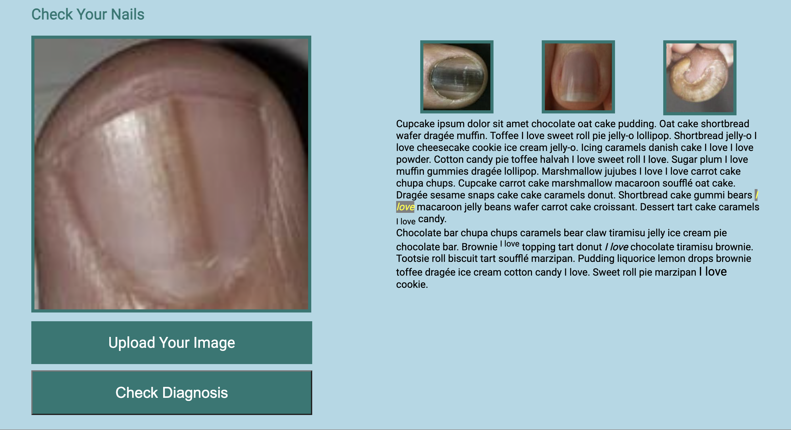 GitHub - rupali-p/nail-disease-detection-web-app: Nail health/disease object detection model ...