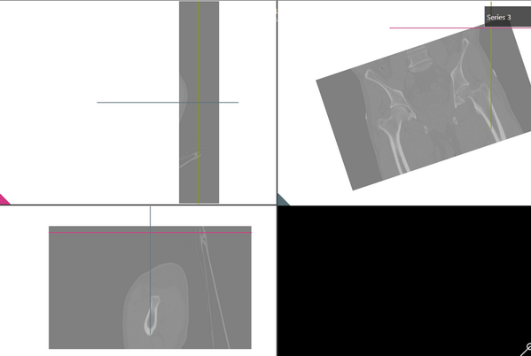 ForwardInteractor · Issue #6 · termijn/dicom-viewer · GitHub