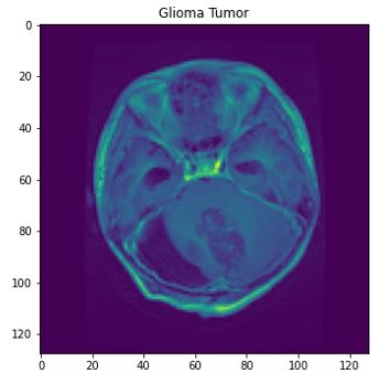 GitHub - ahmedshahjahan/Data-Science-Capstone-Project-Brain-Tumor ...