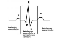 GitHub - MouadSA/TP3-Traitement-d-un-signal-ECG