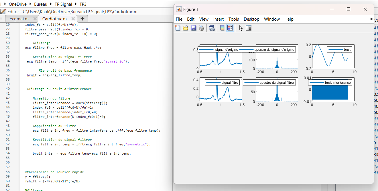 GitHub - MouadSA/TP3-Traitement-d-un-signal-ECG