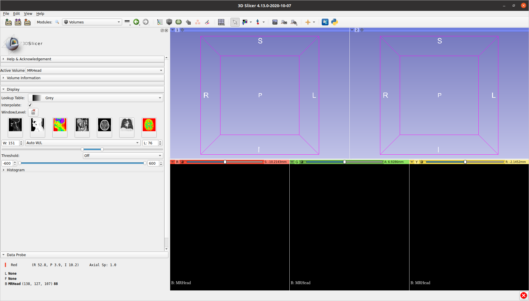 Vtk 9 Slicer Viewer Do Not Show The Slice · Issue 5220 · Slicer