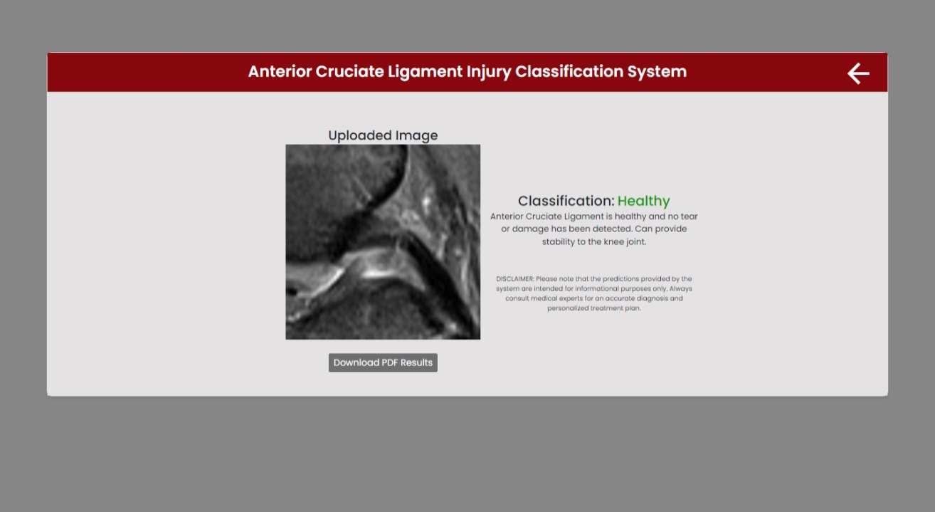 GitHub - karlostuazon/ACL-Injury-Classification-System