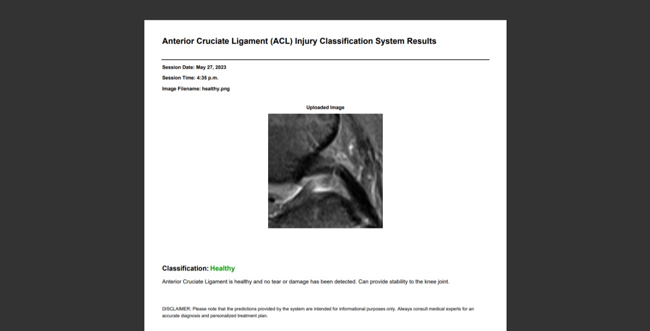 GitHub - karlostuazon/ACL-Injury-Classification-System