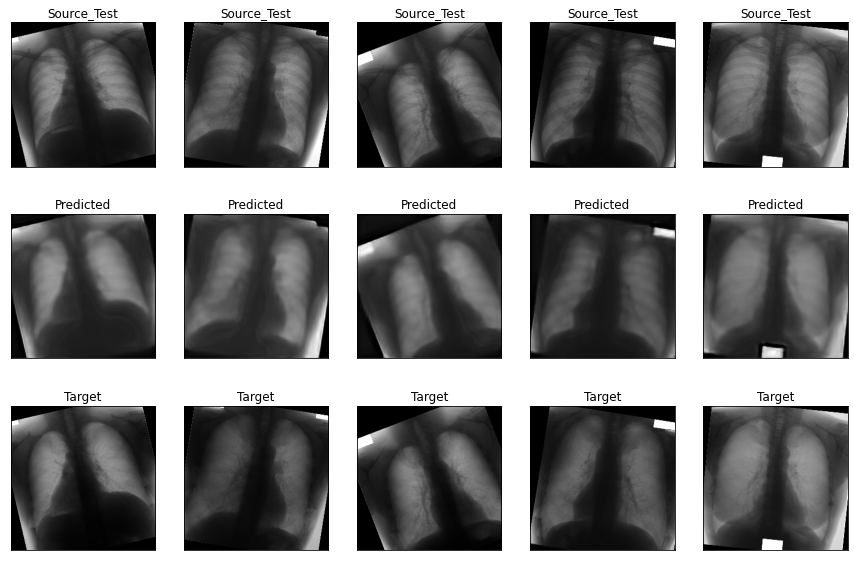 GitHub - nisargdoshi9/bone-suppression-autoencoder