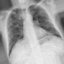 GitHub - nisargdoshi9/XRay_lesion_segmentation_image_registration