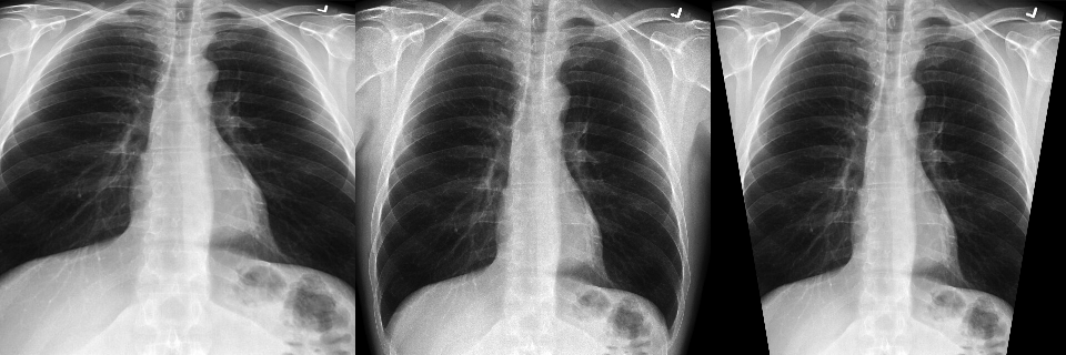 GitHub - nisargdoshi9/XRay_lesion_segmentation_image_registration