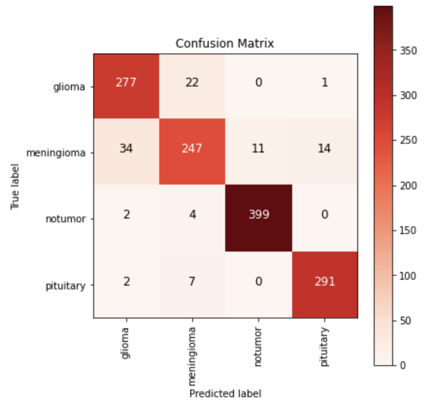 GitHub - ayyucedemirbas/brain_tumor_classification